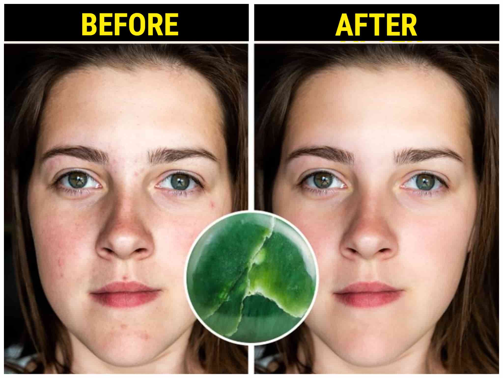 6 Ways Using a Face Roller Can Transform Your Skin