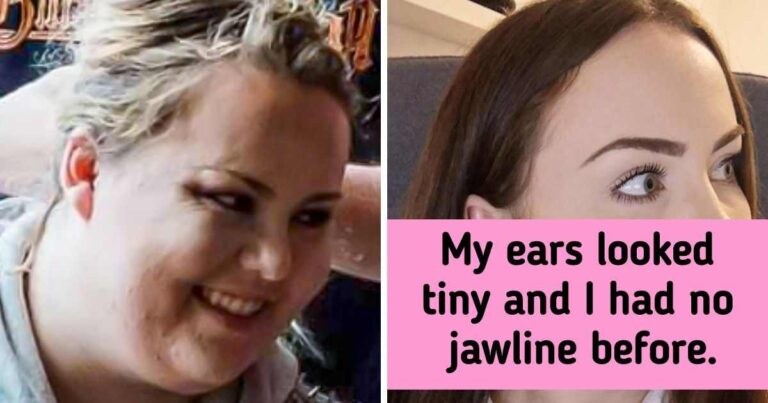 Models Reveal Their “Body Flaws”, and Their Words Can Make You Love ...