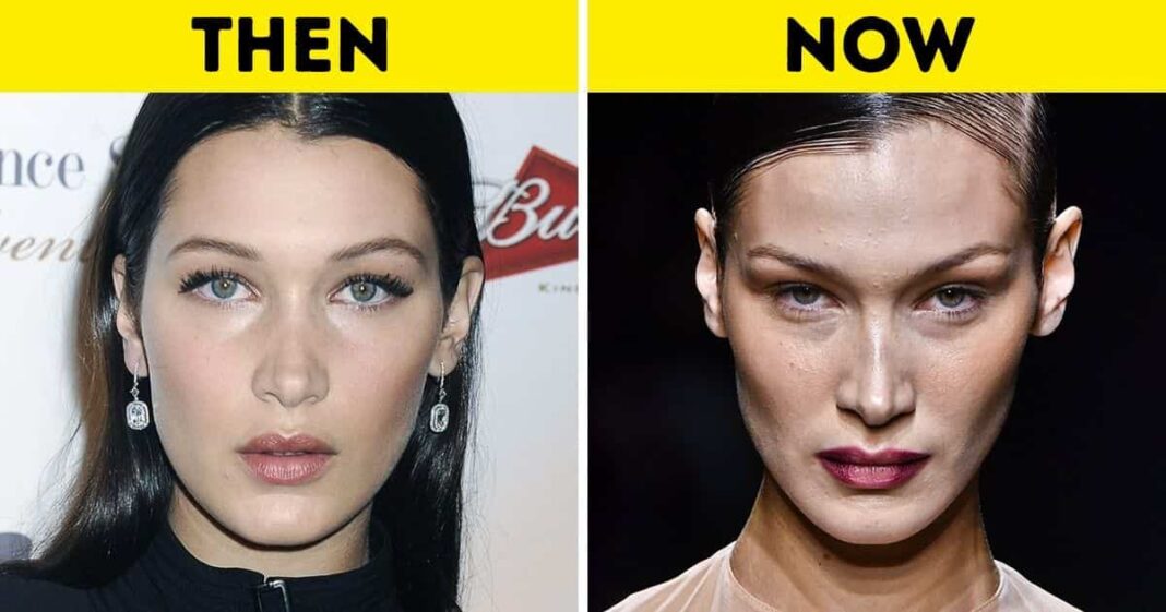 17 Celebrities Who Decided to Say Goodbye to Their Chubby Cheeks