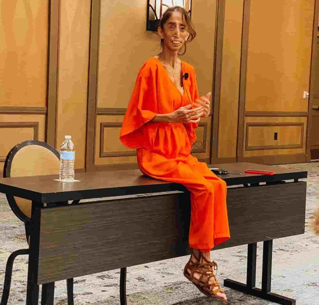 World's skinniest person: Top 5 Skinniest Person in the World